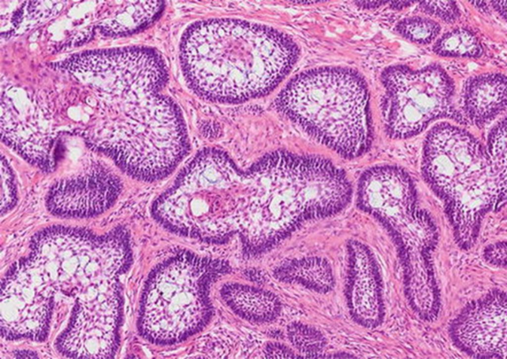 Oral Pathology – FACULTY OF DENTAL SCIENCES